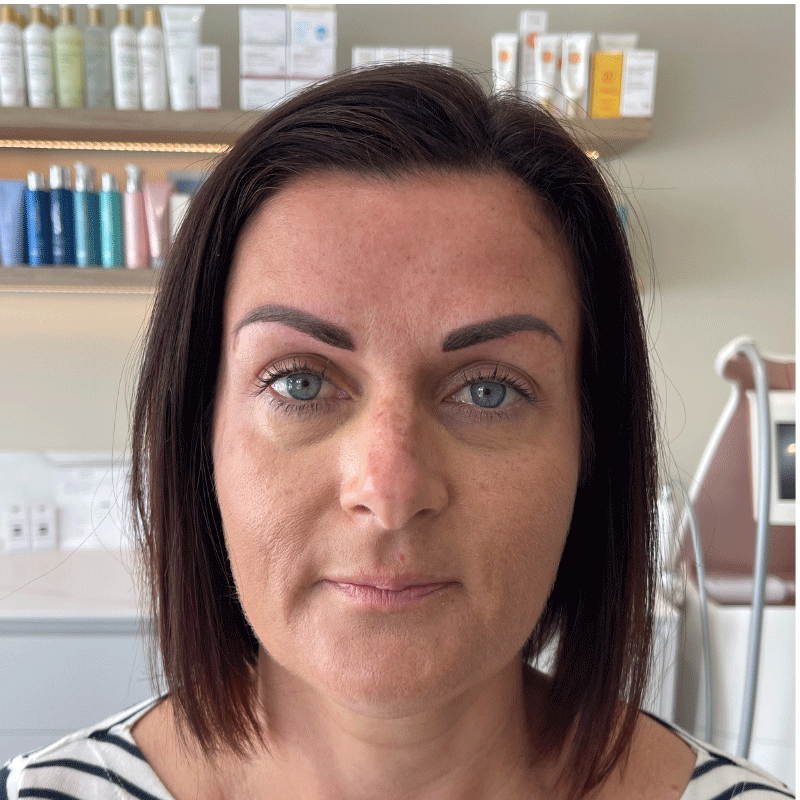 Expert Permanent Makeup in Wimbledon | Lucie Oliver Aesthetics